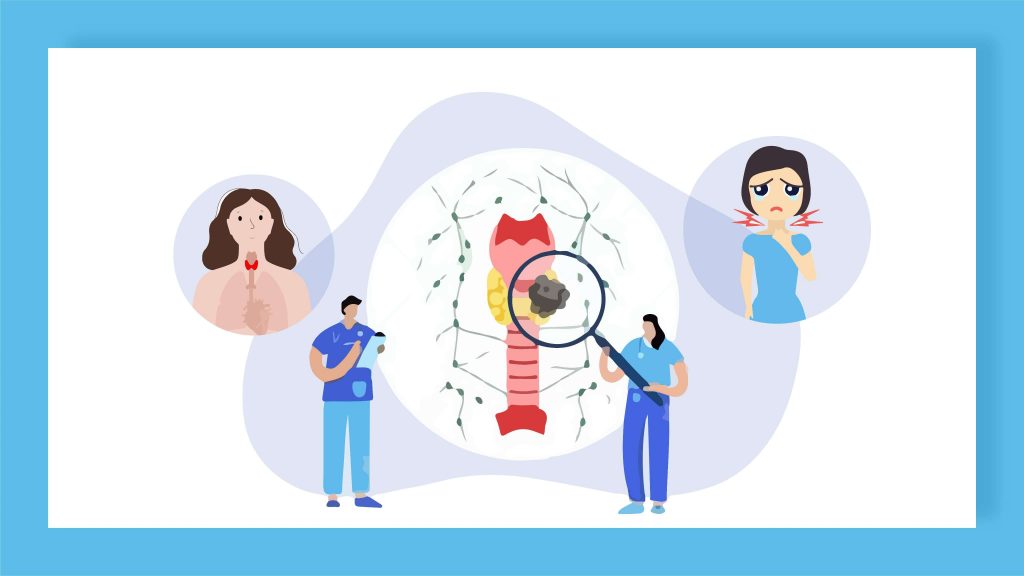 Hyperthyroidism: What Is It, Symptoms, Causes and Treatment
